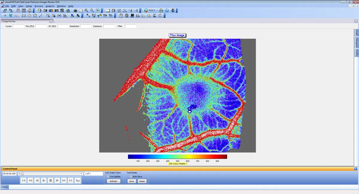 Laser Speckle Contrast Imager - moorFLPI-2 - Moor Instruments