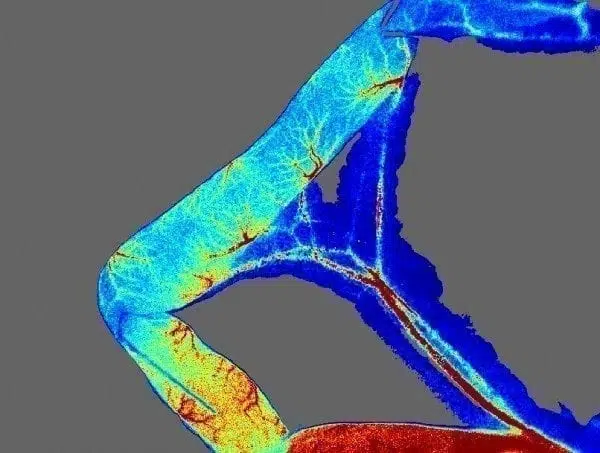 Laser Speckle Contrast Imager - moorFLPI-2 - Moor Instruments